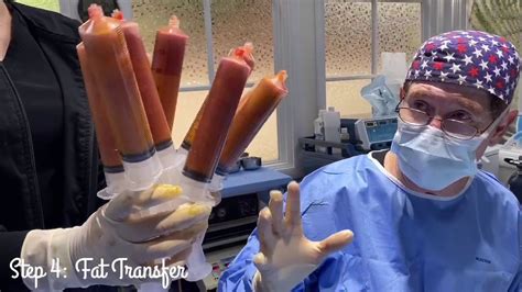 Mommy Makeover Surgery Footage Youtube