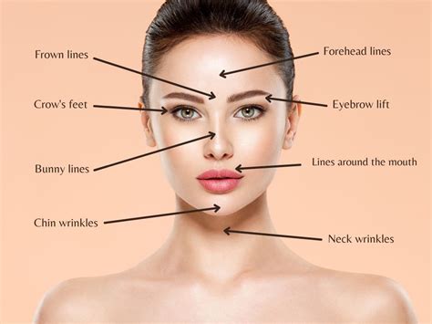 common botox areas that can be treated {8 areas}