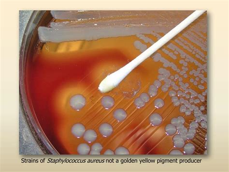Ppt Isolation And Identification Of Staphylococci Powerpoint