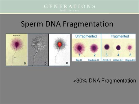 Ppt Andrology And Ivf Laboratory Services Powerpoint Presentation
