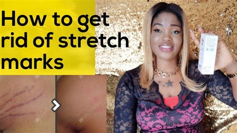How To Get Rid Of Stretch Marks Highly Recommended Oil Youtube