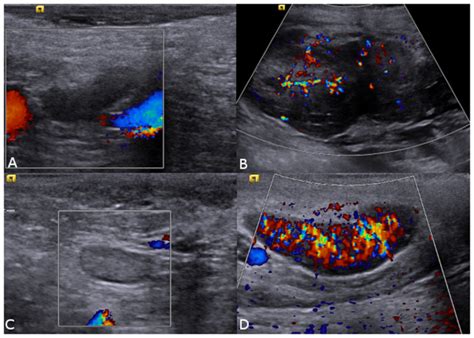 ultrasonography for lymph nodes metastasis identification in bitches