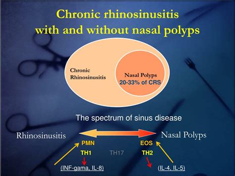 Ppt Nasal Polyps Pathogenesis And Treatment Implications Powerpoint