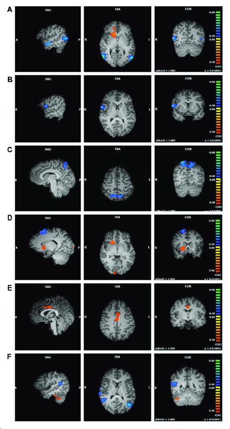 functional connectivity of default mode network dmn clusters