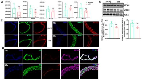 Transcriptome Analysis Of Mouse Aortae Reveals Multiple Novel Pathways