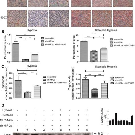 The Hypoxic Microenvironment Induces Lipid Accumulation In Hcc And