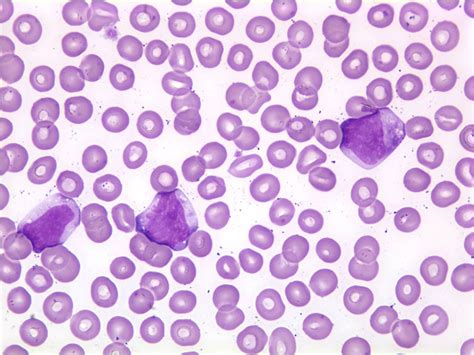 python 2 7 watershed segmentation implementation using scikit image