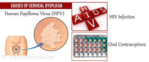 Cervical Dysplasia Causes Symptoms Diagnosis Treatment And Prevention