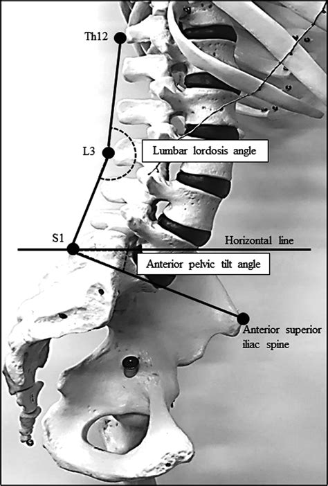 A Skeleton Model Showing The Angles Of Lumbar Lordosis And Anterior