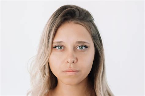 Mujer Joven Con Ojos Almendrados Después De Blefaroplastia Maquillaje