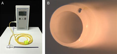 use of a pressure sensing sheath comparison with standard means of