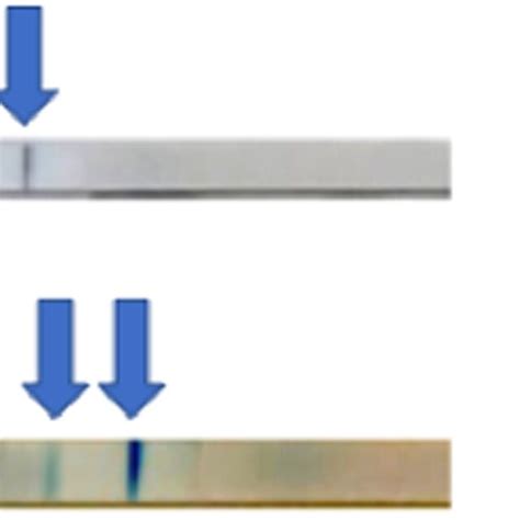 A Site‐specific Ammp‐8 Poc Lateral‐flow Immunoassay Gingival Crevicular