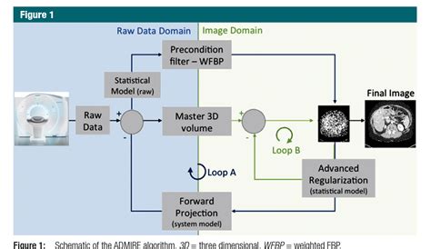 Diagnostic Performance Of An Advanced Modeled Iterative Reconstruction