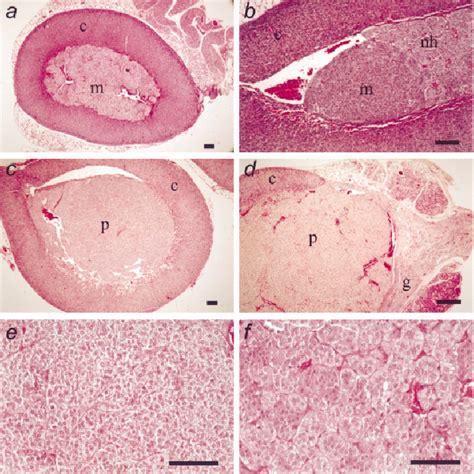 Histological Sections Of Ret Men2b Mutant Adrenals A Wild Type