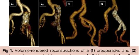 Figure 1 From Institutional Retrospective Review Of Ultrasound