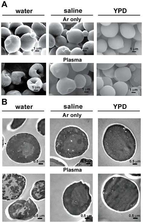 Yeast Cell Structure