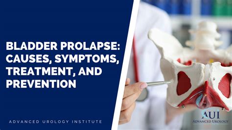 Bladder Prolapse Causes Symptoms Treatment And Prevention