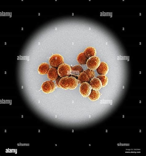 Enterococcus Faecalis Bacteria Coloured Scanning Electron Micrograph