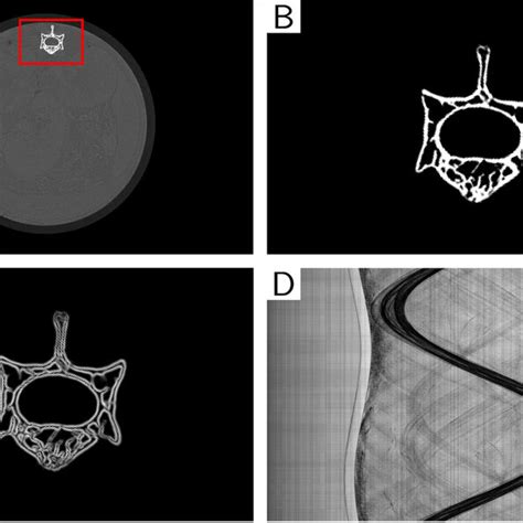 Pdf Statistical Iterative Reconstruction Algorithm For X Ray Phase