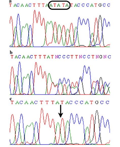 Sequence Analysis Of The Liph Gene Mutation Dna Sequence Of Exon 2