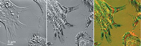Methods For Imaging Thick Specimens Confocal Microscopy Deconvolution