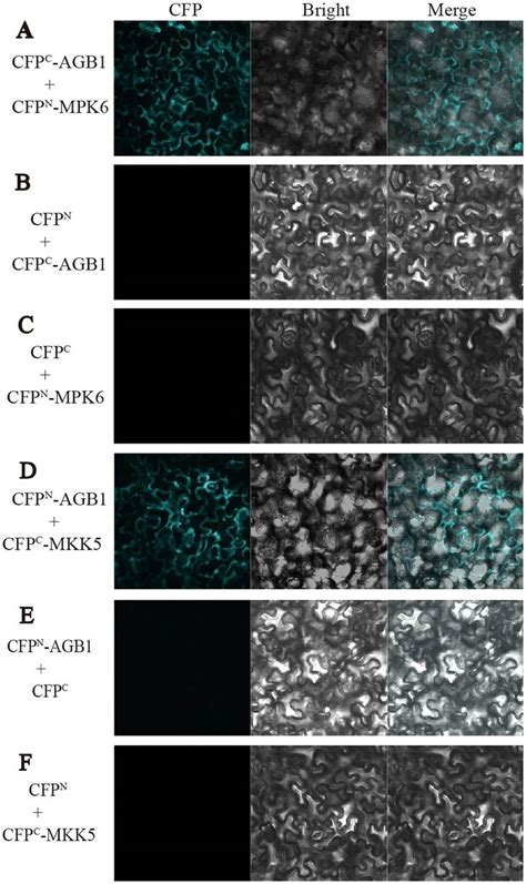 Bimolecular Fluorescence Complementation Analysis Showing The