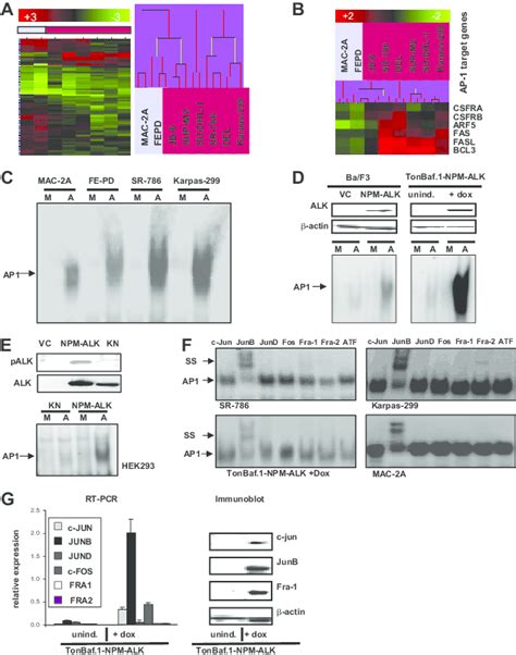 Ap 1 Transcription Factor Activity Is Increased In Npm Alk Containing