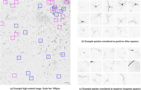 Part Of A High Content Fluorescence Microscopy Image A Where The Blue