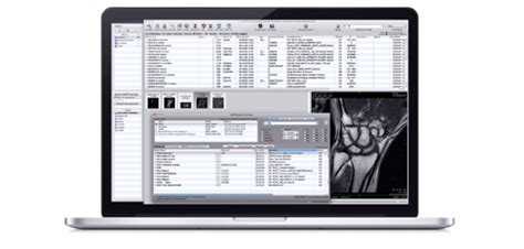 osirix dicom viewer osirix md