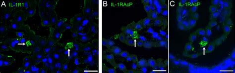 Presence Of Il 1β Receptor Expressing Cells In The Choroid Plexus