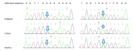Sanger Sequencing Validation Of The Ttc7a Variants Download