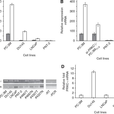 Expression Of Genes Prkc Z And Prkc I In Prostate Epithelial Cells A