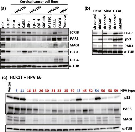 Roles Of The Pdz‐binding Motif Of Hpv 16 E6 Protein In Oncogenic