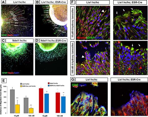 Distinct Dose Dependent Cortical Neuronal Migration And Neurite