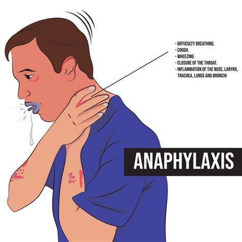 Anaphylaxis