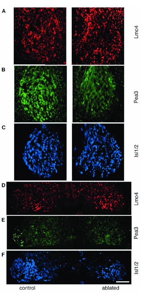 Limb Ablation Does Not Alter Lmo4 Expression Limb Ablations Were