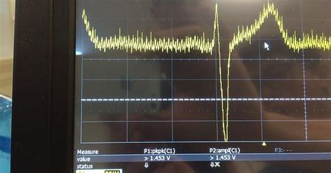 Ecg Output Album On Imgur