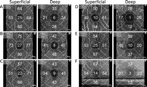 Identification Of Imaging Features That Determine Quality And