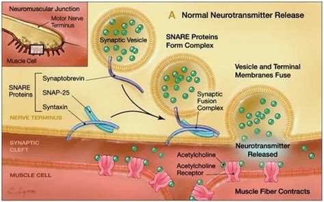 Botox Exploring The Types Of Botulinum Toxin Used Justinboey