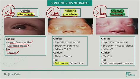 Neonatología Conjuntivitis Neonatal Youtube