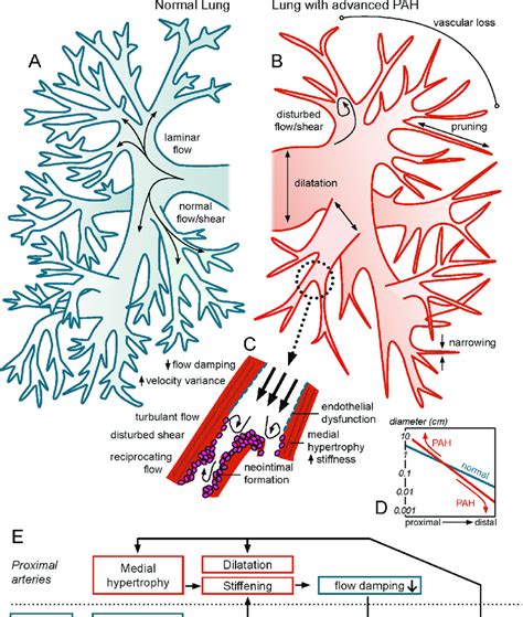 Schematic Representation Of The Pulmonary Arterial Tree In The Normal