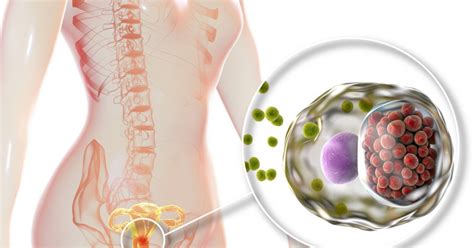 clamidiasis causas síntomas y tratamiento