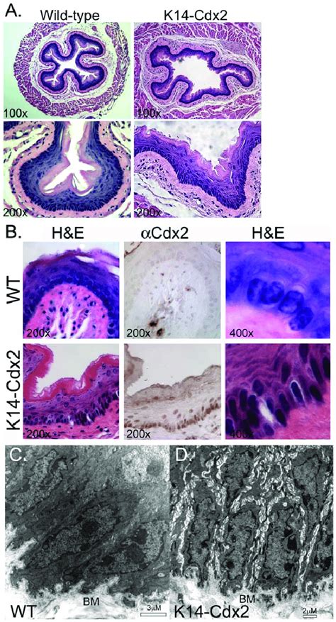 Transgene Expression Alters Basal Epithelial Cell Morphology And