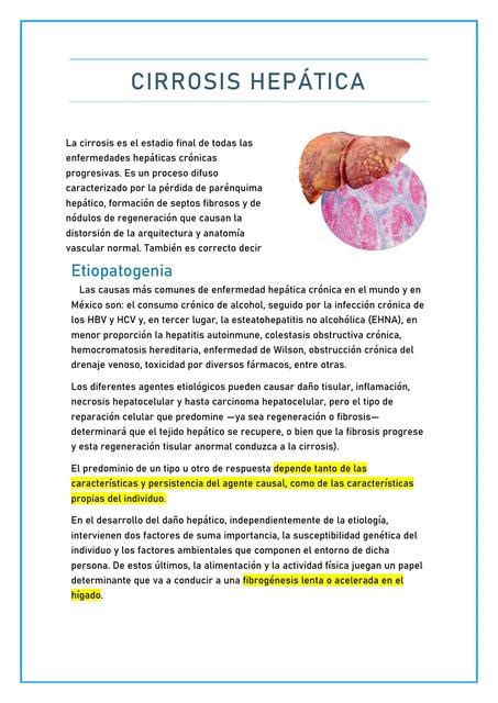 Cirrosis Hepática Juniegxis Guevara Udocz