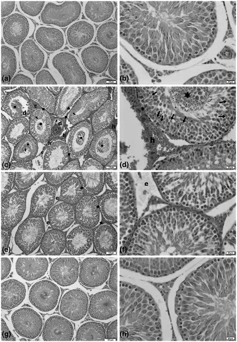 Microscopic View Of Testicular Tissues By Groups Testicular Sections