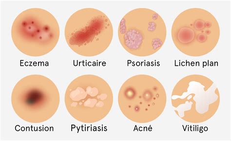 Tolérance Dermatologique Peau Allergies Cutanées Panéliste