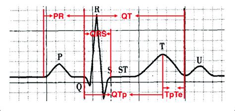 Definition Of Ecg Parameters Download Scientific Diagram