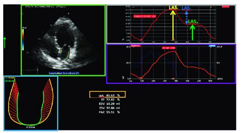 Left Atrial Strain Measurement Region Of Interest Of The Left Atrial