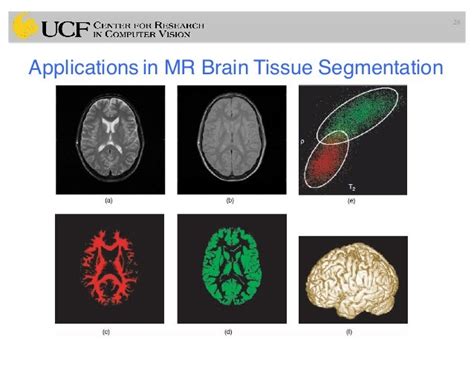 Lec13 Clustering Based Medical Image Segmentation Methods