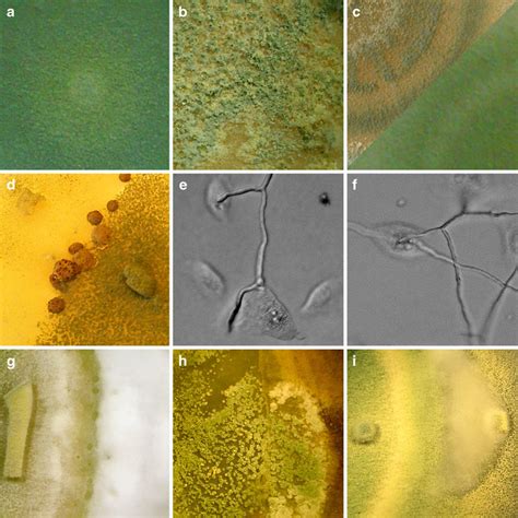 Characteristic Features Of Trichoderma Spp A T Reesei And B T